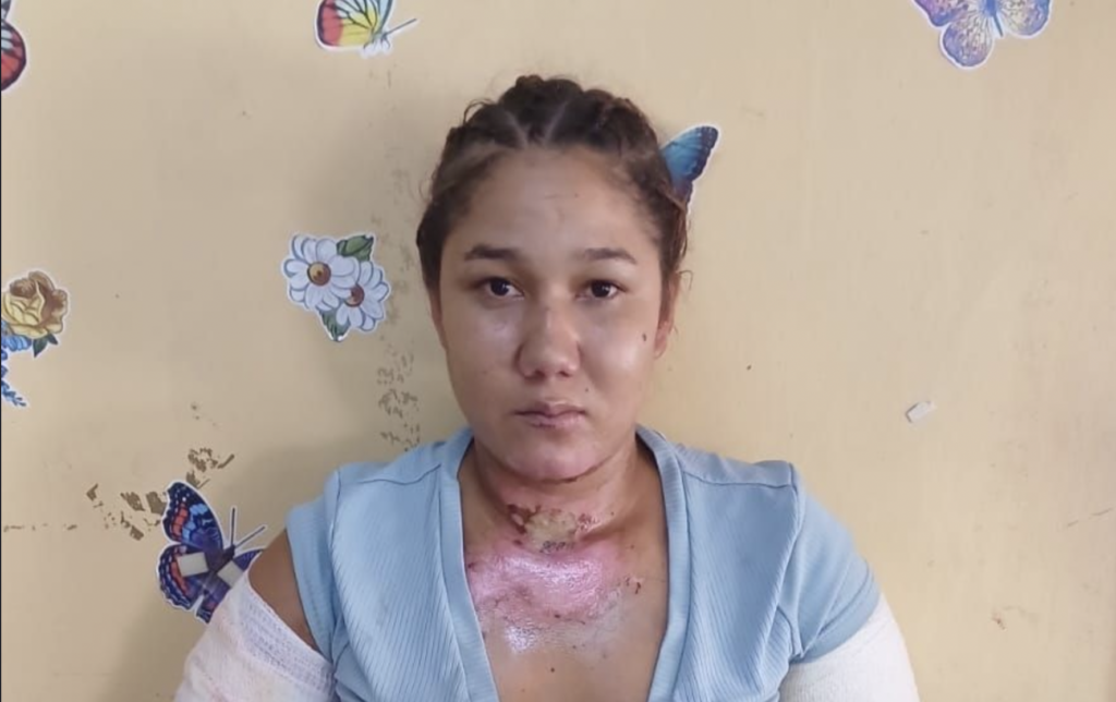 Venezuelan woman remanded to prison over attempted murder of lover ...